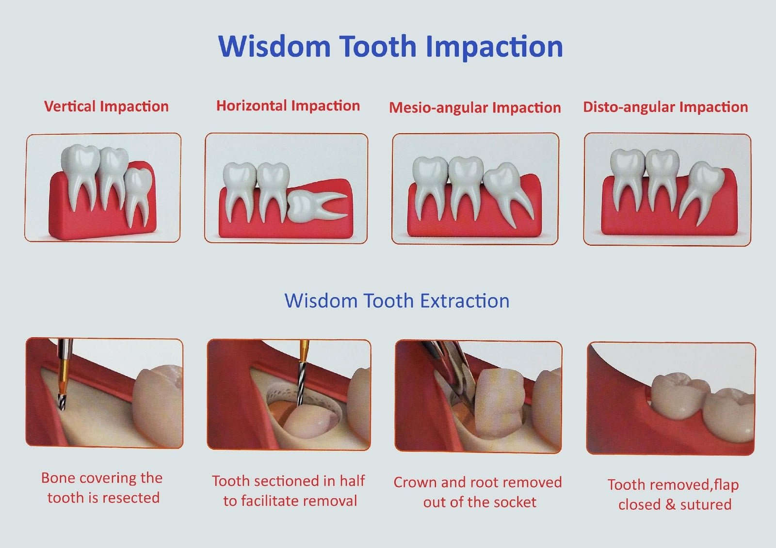 Oral Surgery in Vizag - Suraksha Dental Clinic